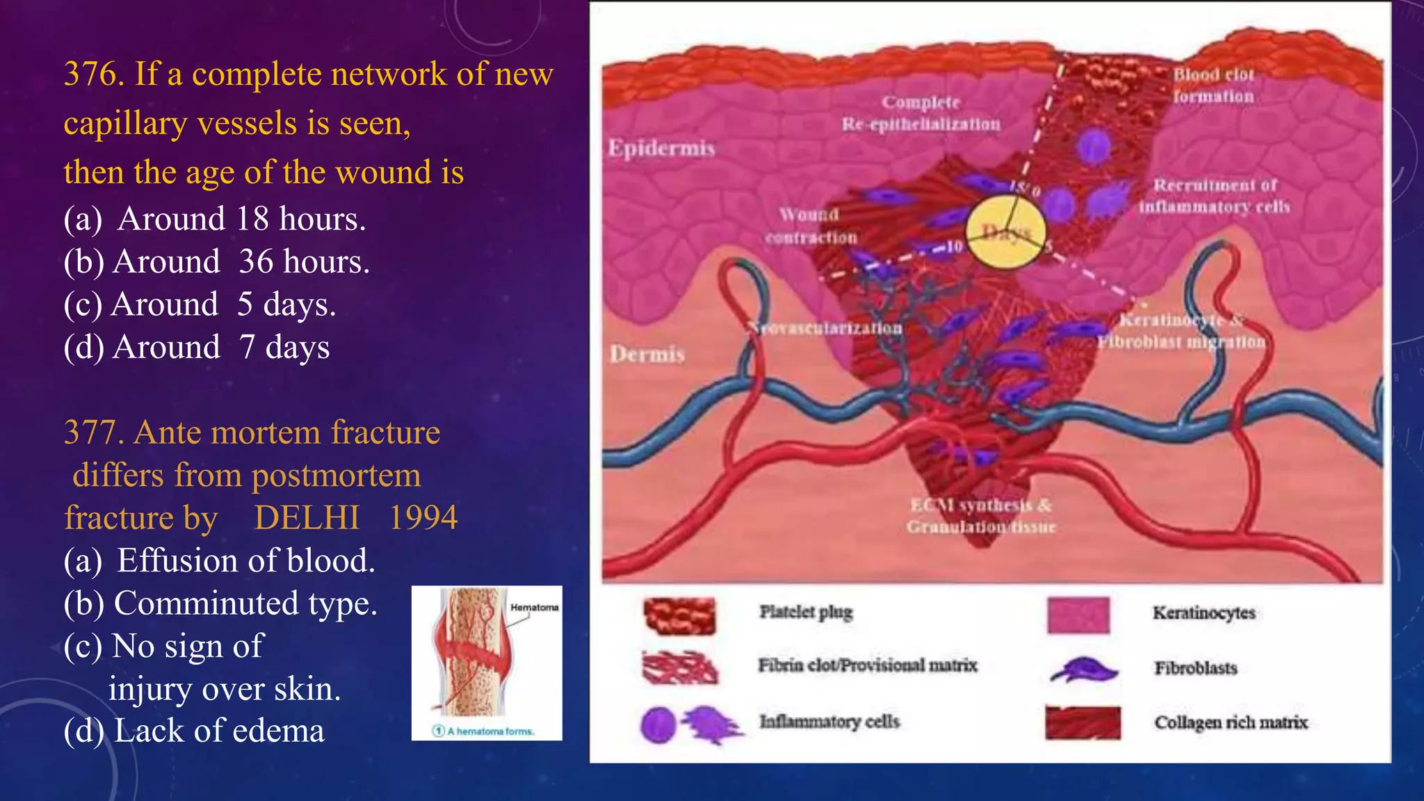 MCQ in MLI of wounds ppt | PPTX