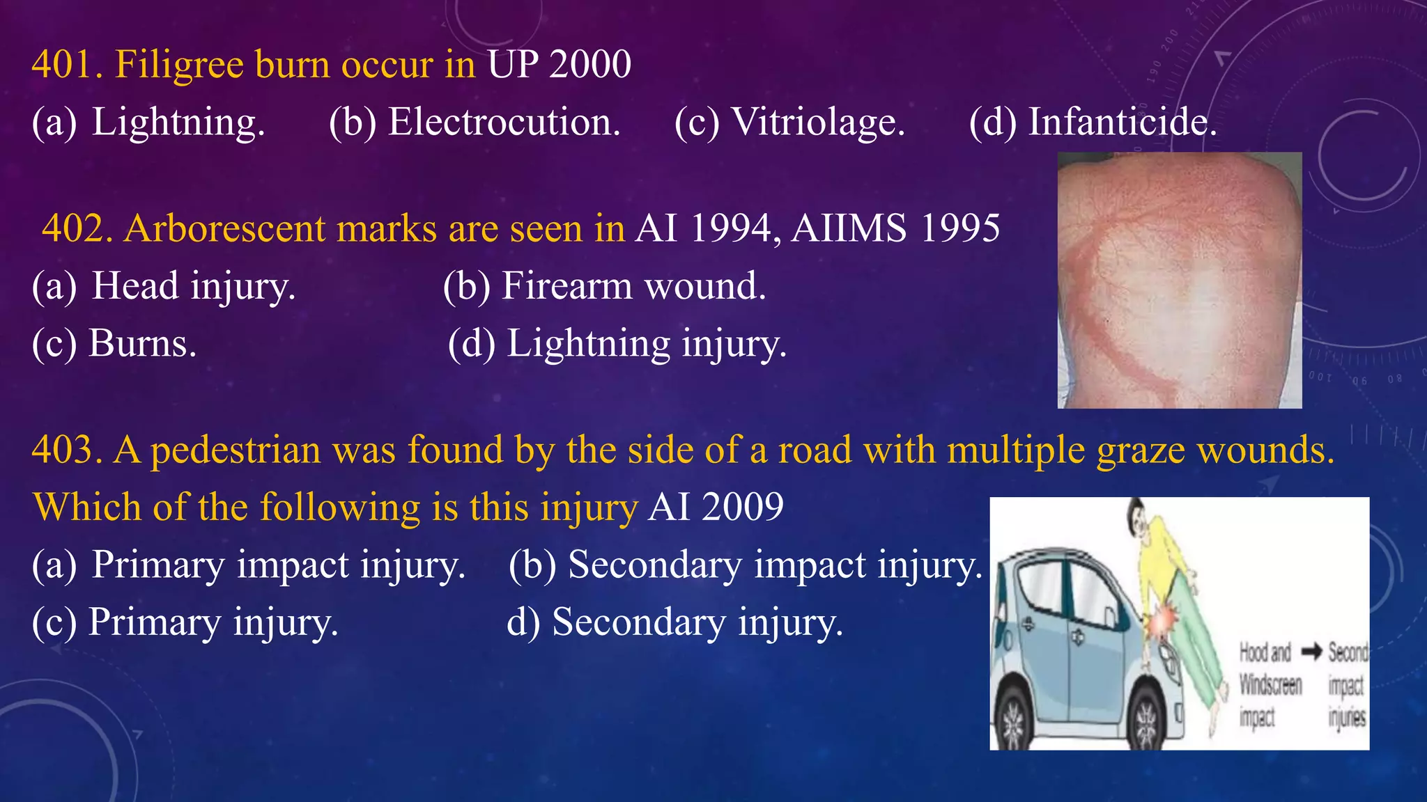 MCQ in MLI of wounds ppt | PPTX