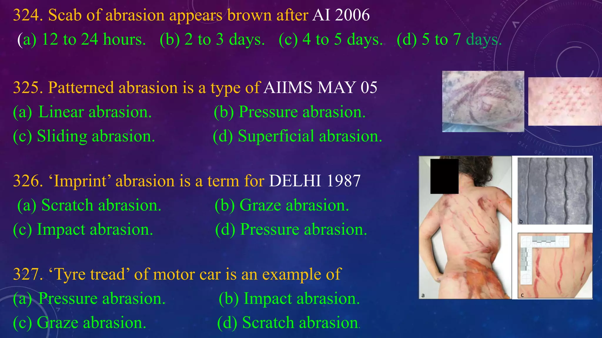 MCQ in MLI of wounds ppt | PPTX