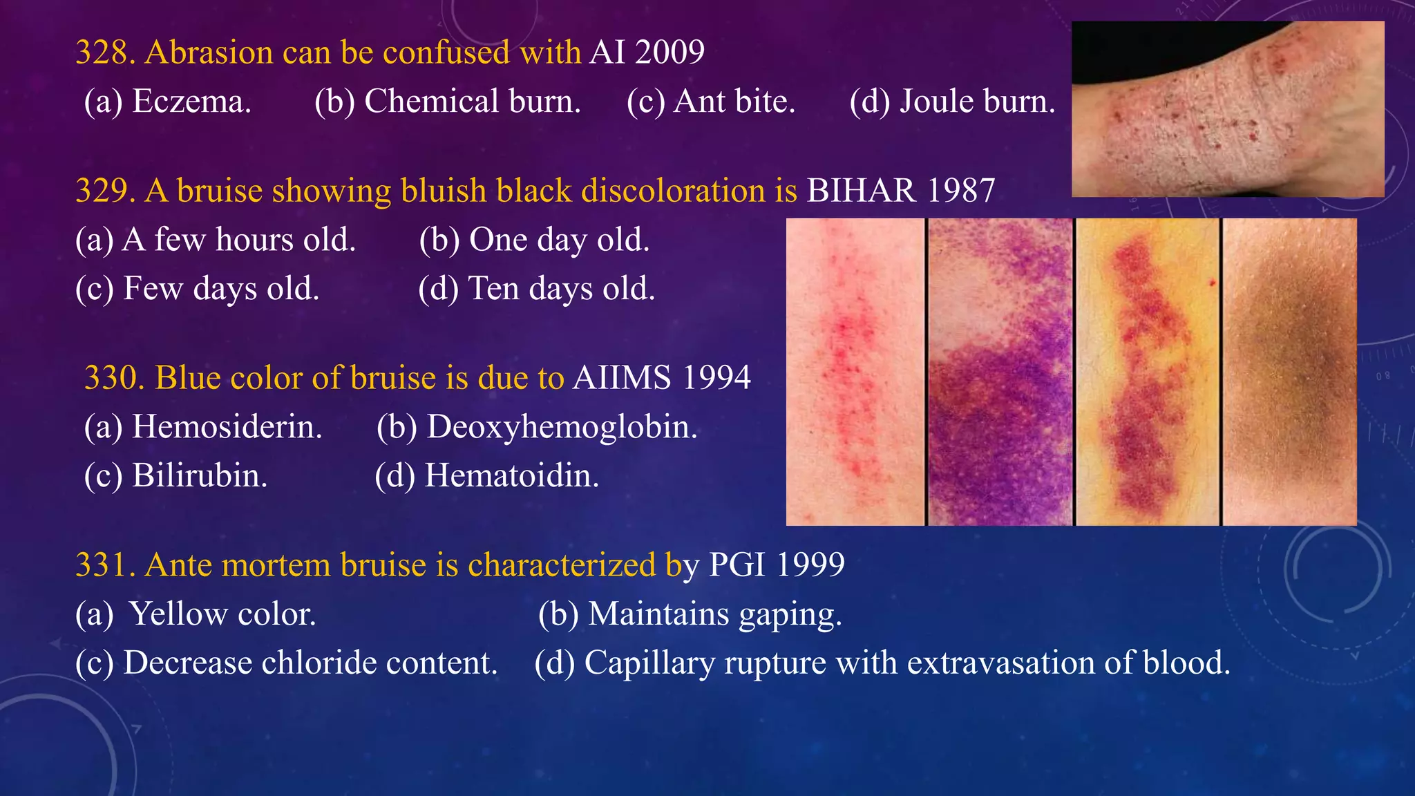 MCQ in MLI of wounds ppt | PPTX