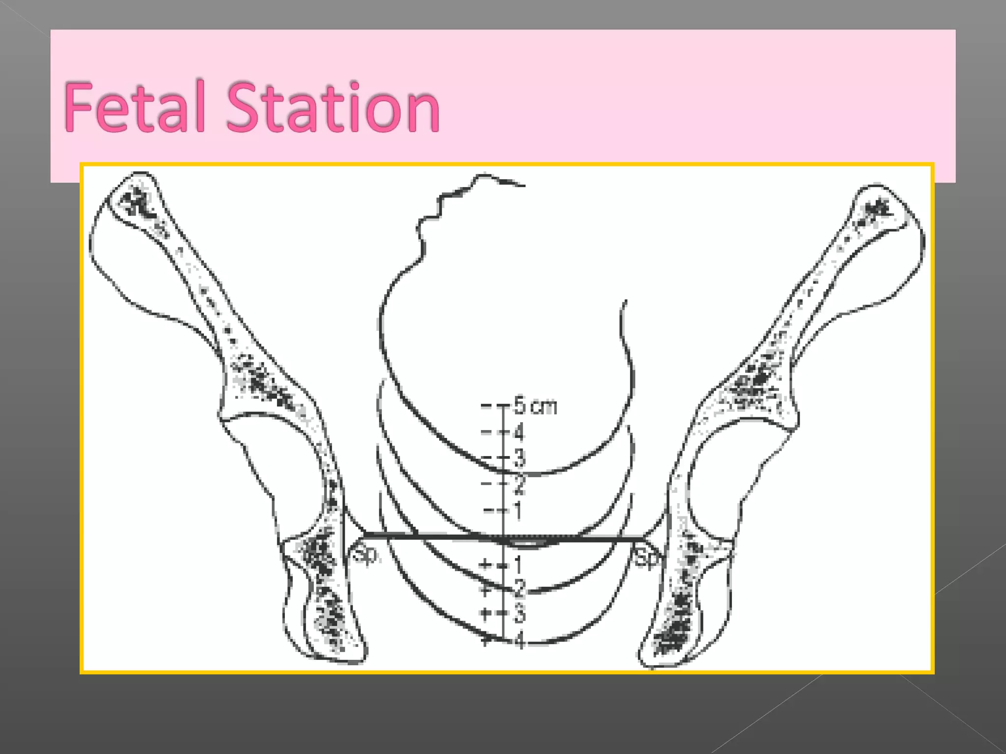 Mcq on normal and abnormal labor for undergraduate | PPT