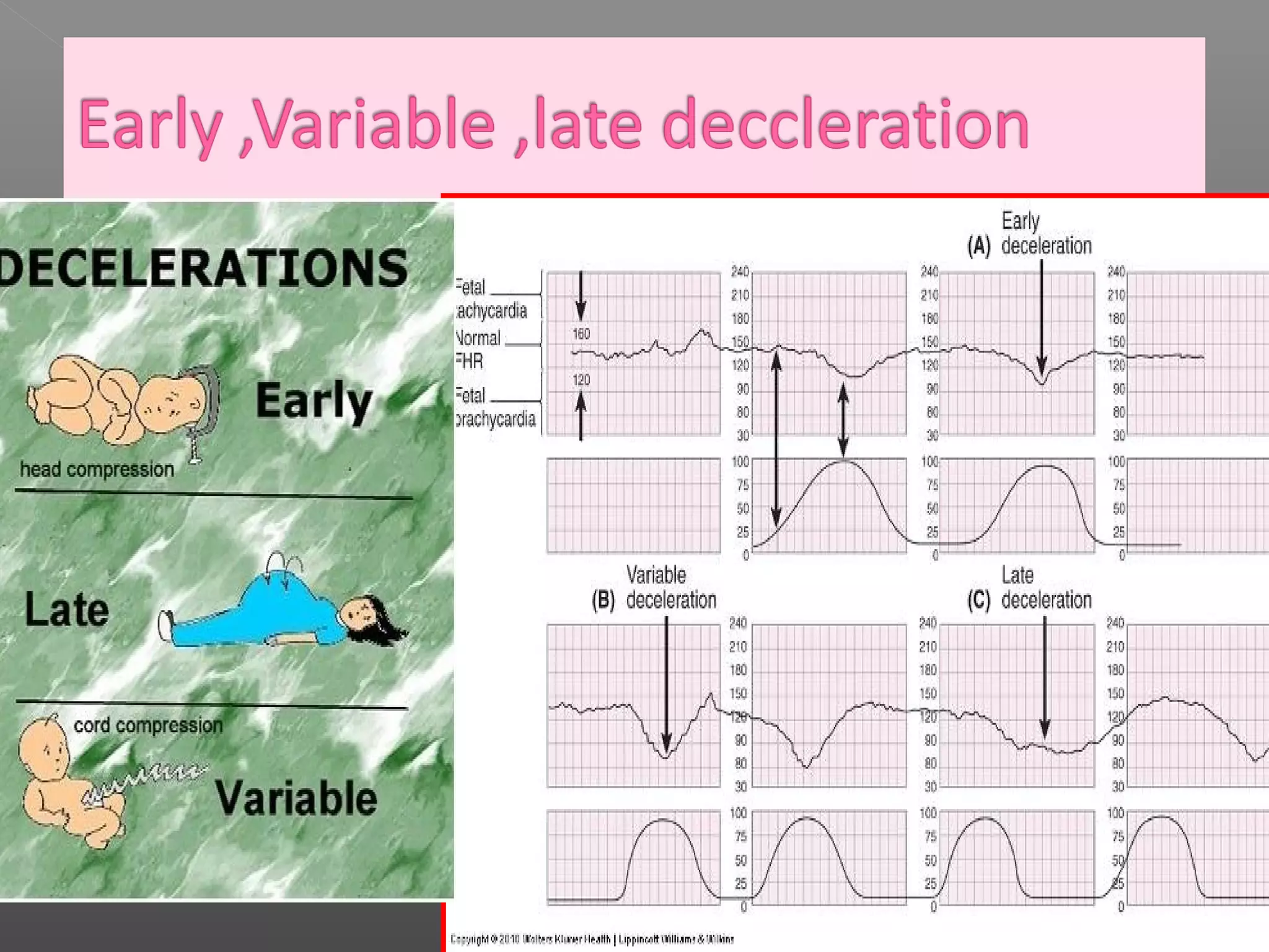 Mcq on normal and abnormal labor for undergraduate | PPT