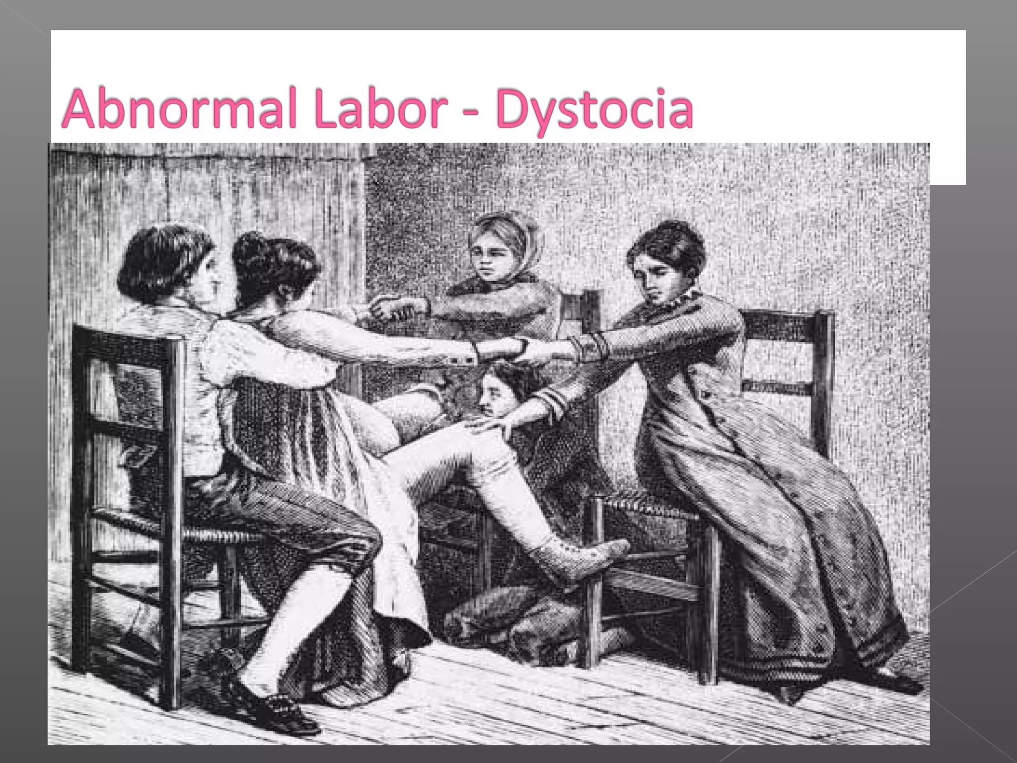 Mcq on normal and abnormal labor for undergraduate | PPT