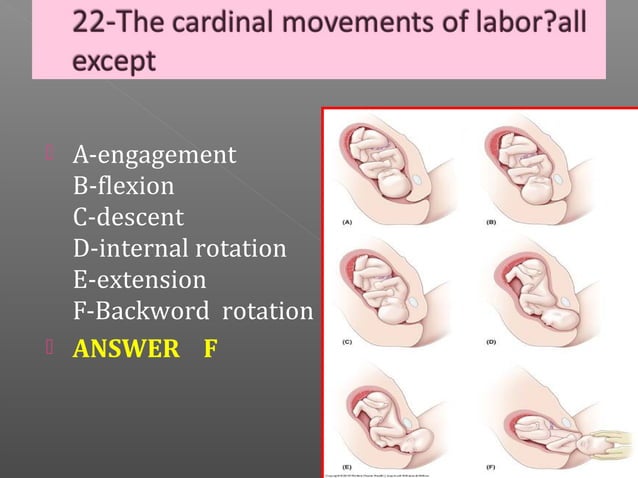 Mcq on normal and abnormal labor for undergraduate | PPT | Pregnancy ...