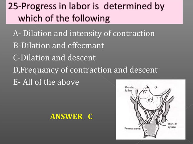 Mcq on normal and abnormal labor for undergraduate | PPT | Pregnancy ...