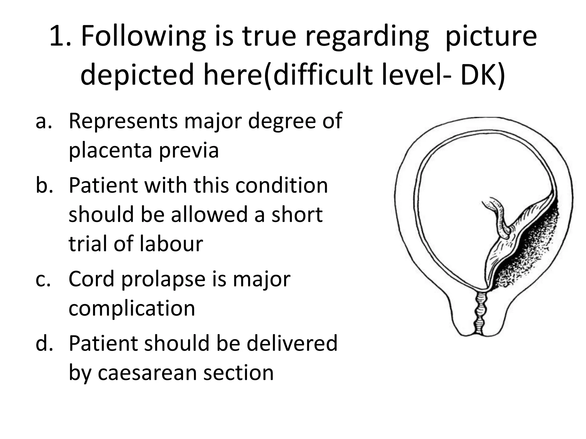 Neet MCQs - Specimens.OBG