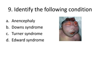 Neet MCQs - Specimens.OBG