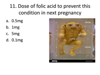 Neet MCQs - Specimens.OBG