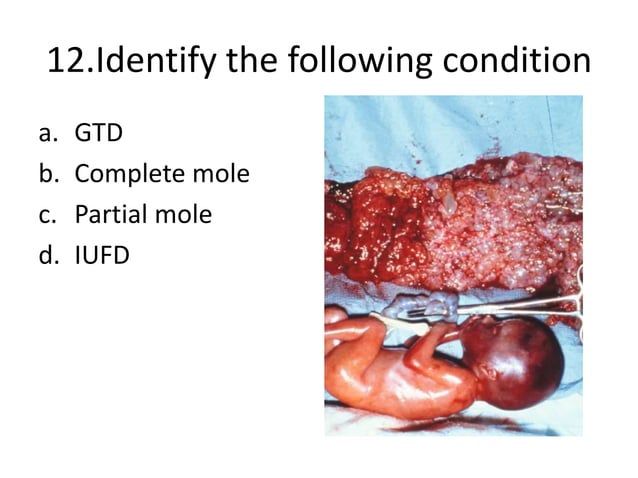 Neet MCQs - Specimens.OBG | Pregnancy | Reproductive Health