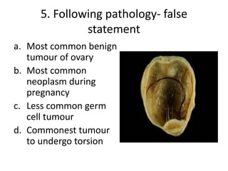Neet MCQs - Specimens.OBG
