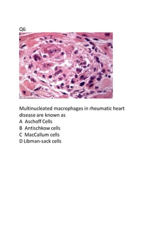 Mcqs images cvs | DOCX