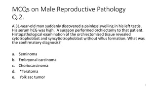 MCQs in male reproductive pathology ss1 | PPTX