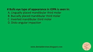 MCQs on Tooth Extraction (Exodontia) and Impactions | PPTX
