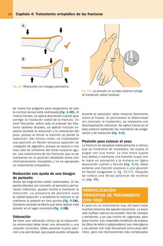 McRae_Traumatología_Tratamiento_de_las_fracturas_en_urgencias_Tercera.pdf
