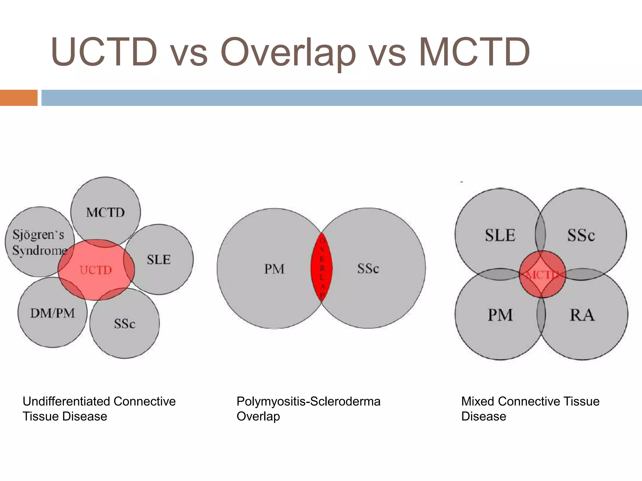 Mixed connective tissue disorder | PPTX | Diseases and Conditions ...