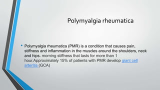 MCTD SJOGREN SYNDROME PMR | PPTX