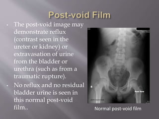 Voiding cystourethrogram used in Diagnostic Radiology | PPT