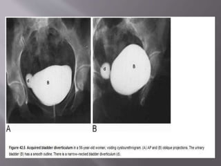 Voiding cystourethrogram used in Diagnostic Radiology | PPT