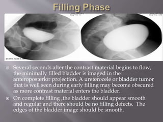 Voiding cystourethrogram used in Diagnostic Radiology | PPT