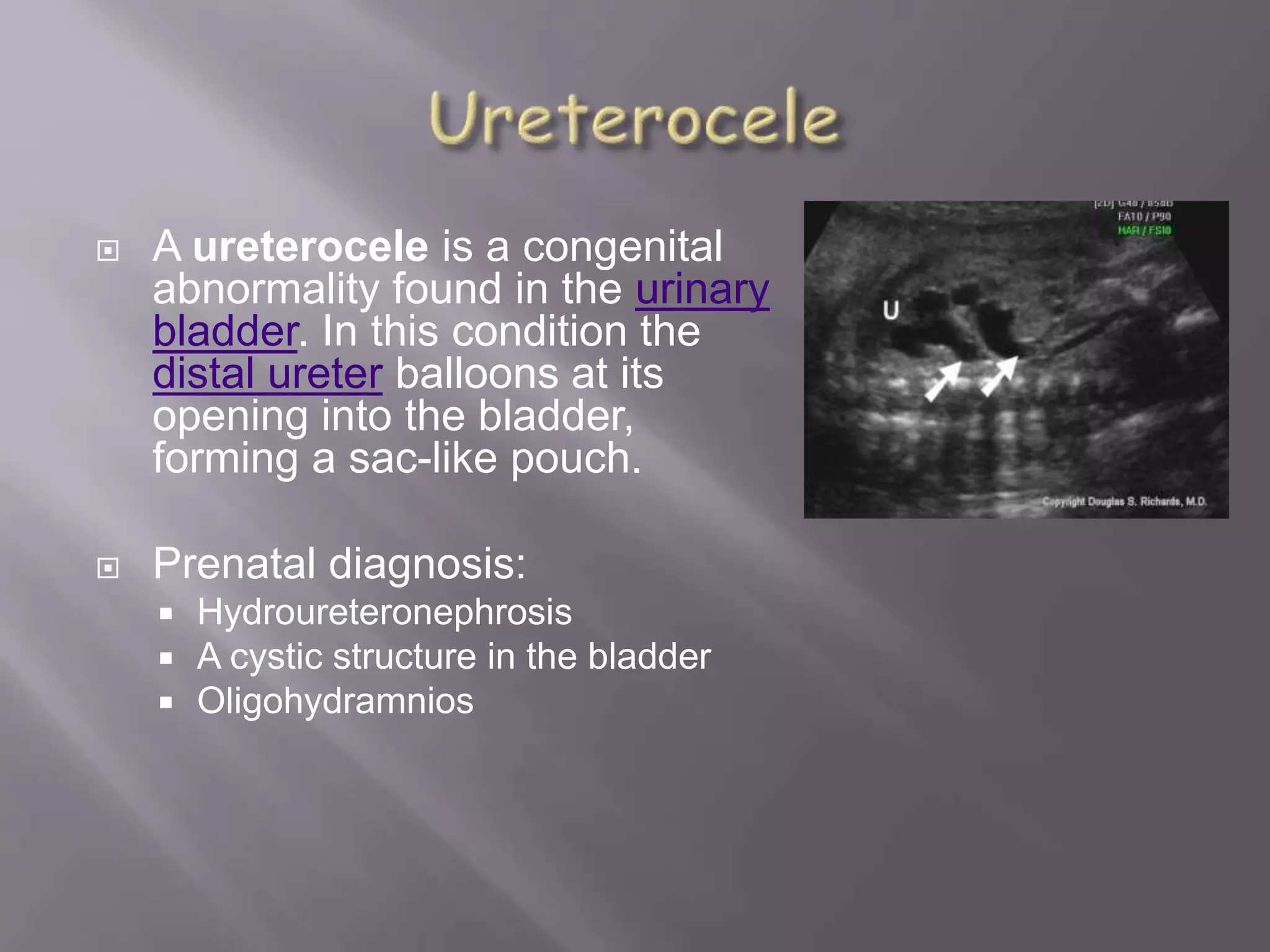 MCU- Micturating cysto-urethrogram | PPTX