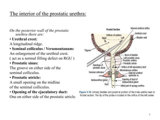 RGU (Retrograde urethrogram), MCU (Micturating cystourethrogram) and ...