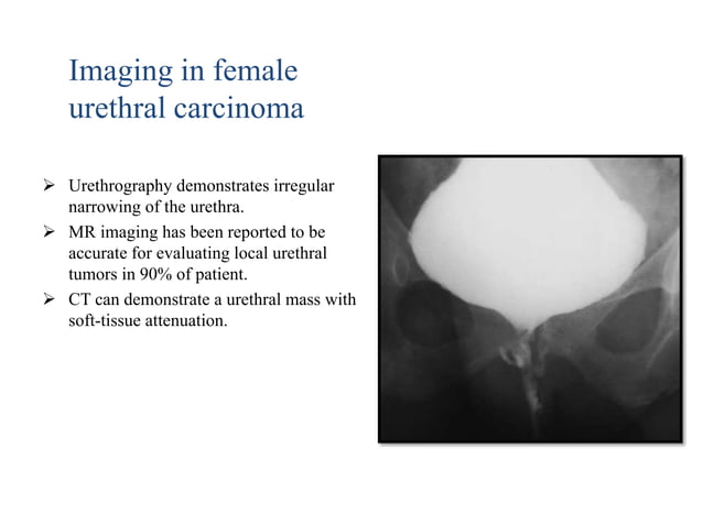 RGU (Retrograde urethrogram), MCU (Micturating cystourethrogram) and ...