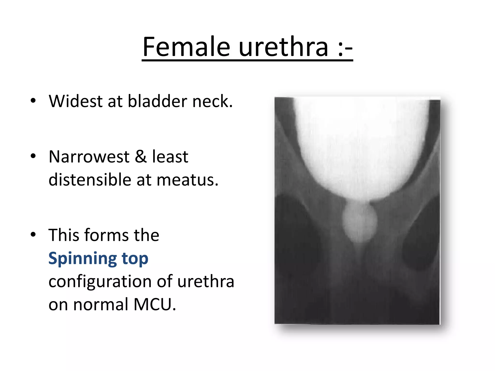 RGU MCU and its interpretation in pathology of Urinary Bladder ...