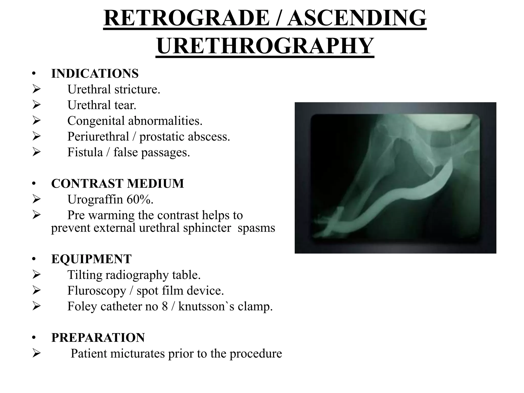 RGU MCU and its interpretation in pathology of Urinary Bladder ...