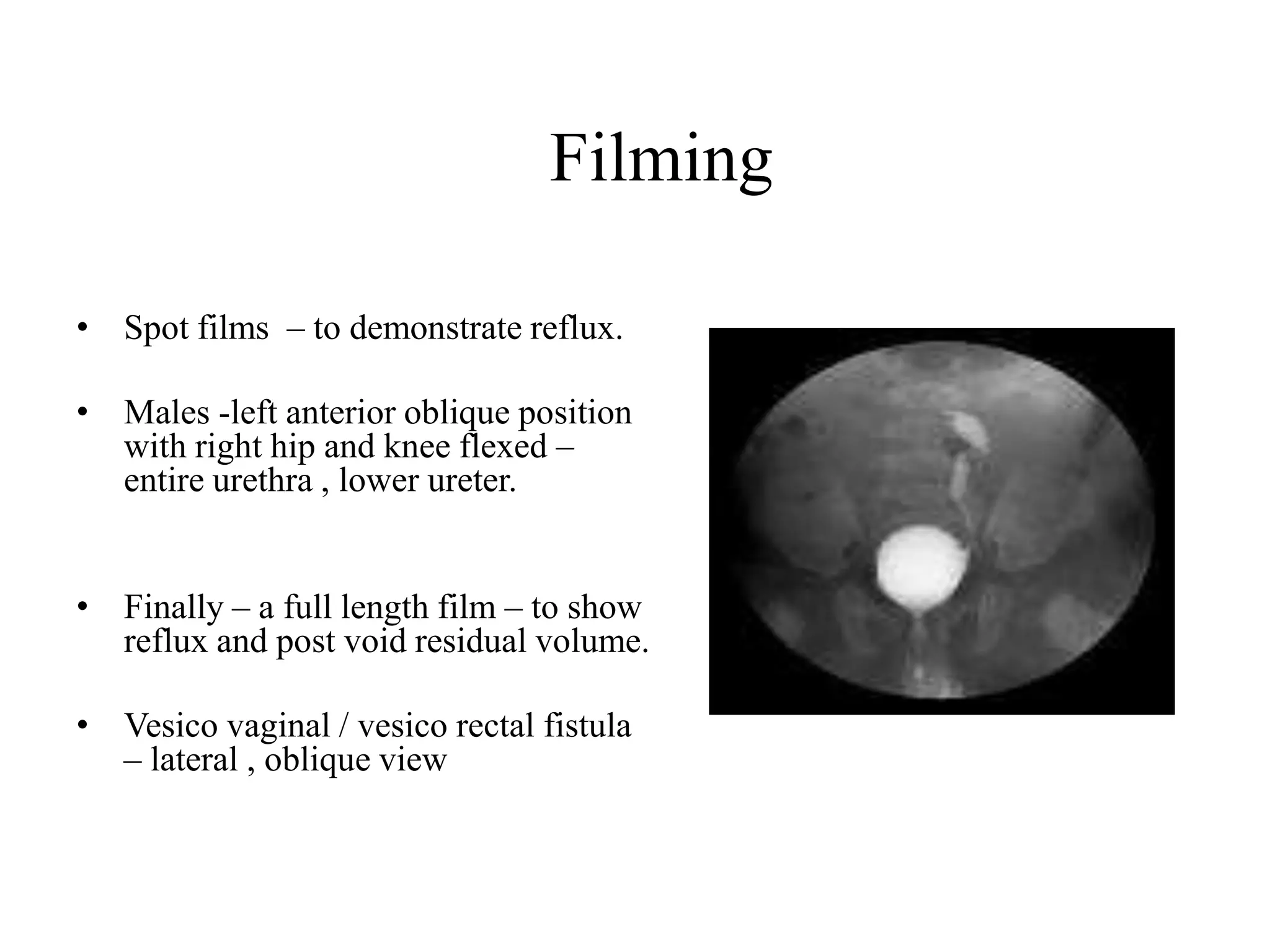 RGU MCU and its interpretation in pathology of Urinary Bladder ...