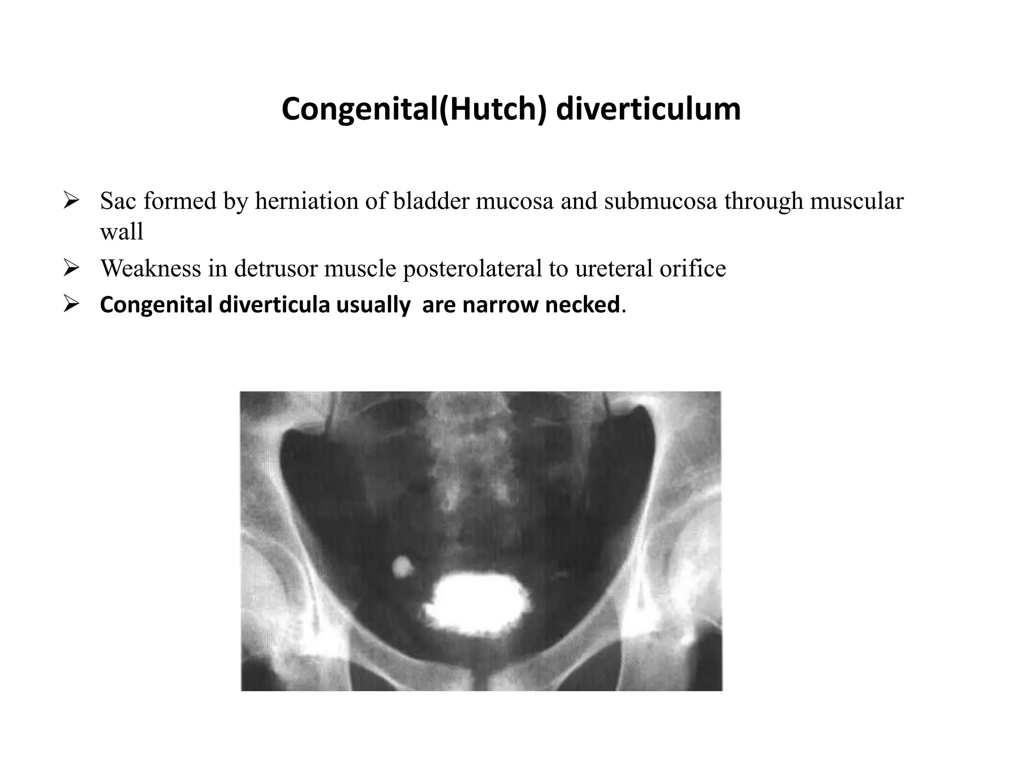 RGU MCU and its interpretation in pathology of Urinary Bladder ...