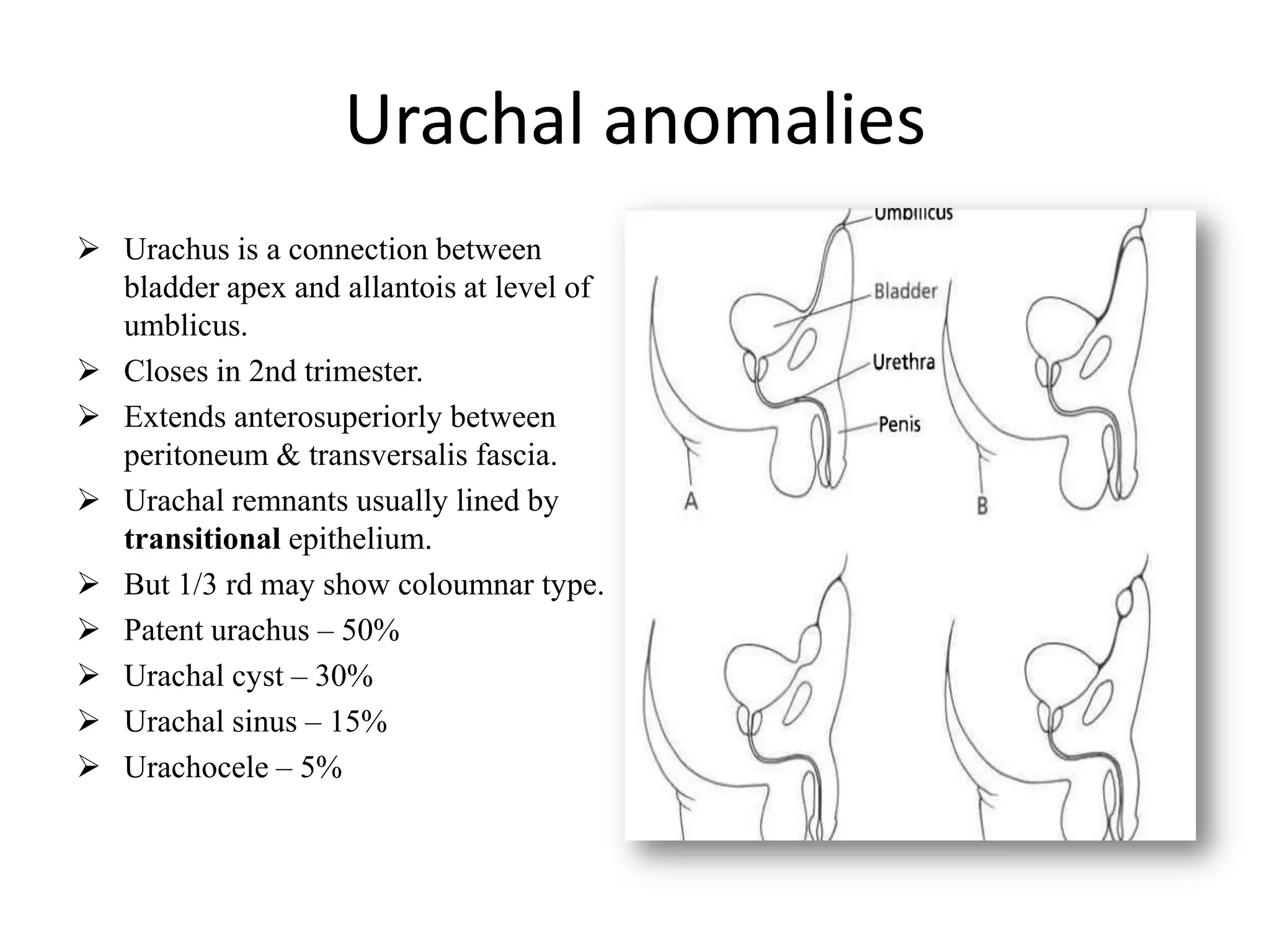 RGU MCU and its interpretation in pathology of Urinary Bladder ...