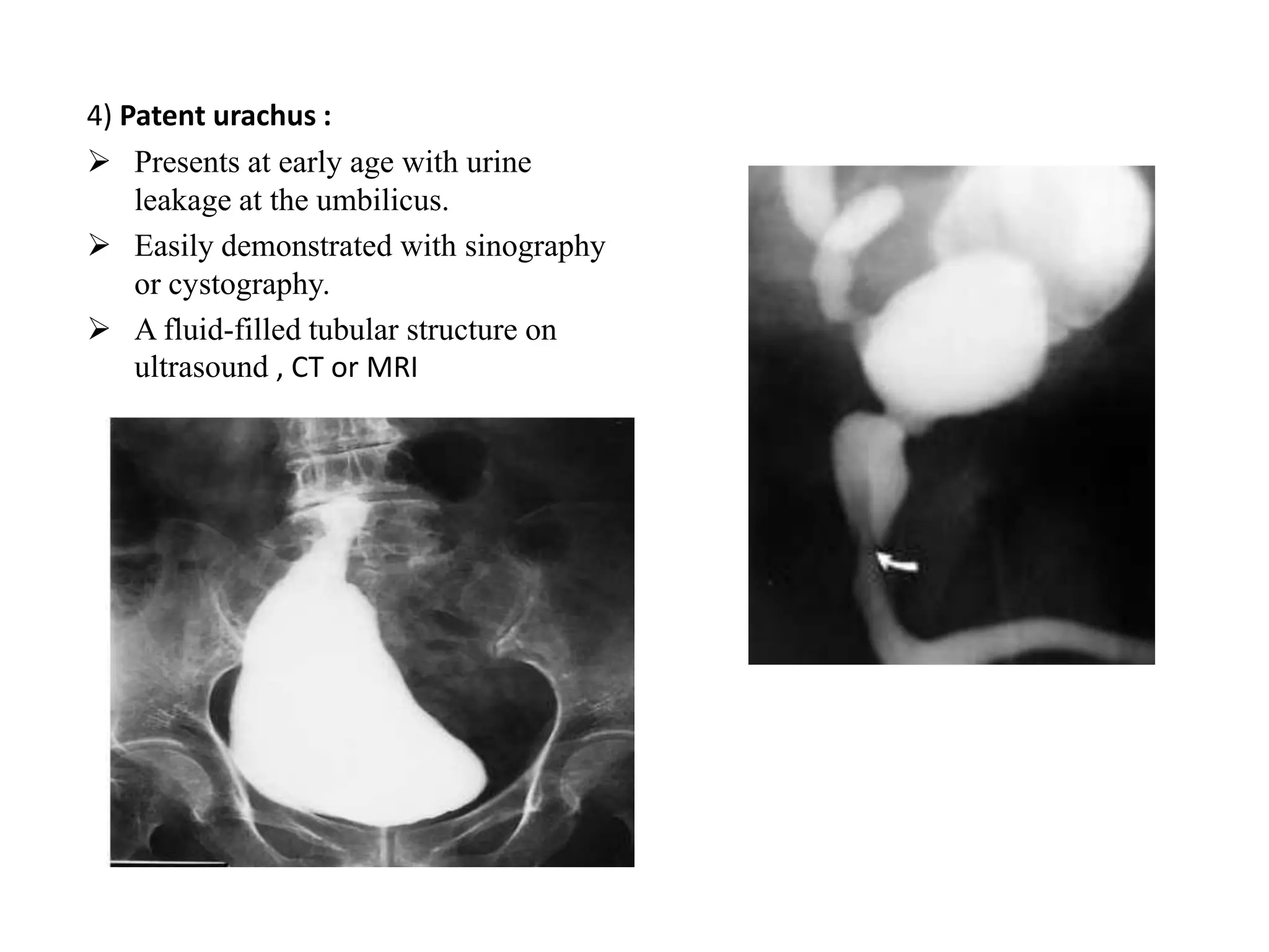 RGU MCU and its interpretation in pathology of Urinary Bladder ...