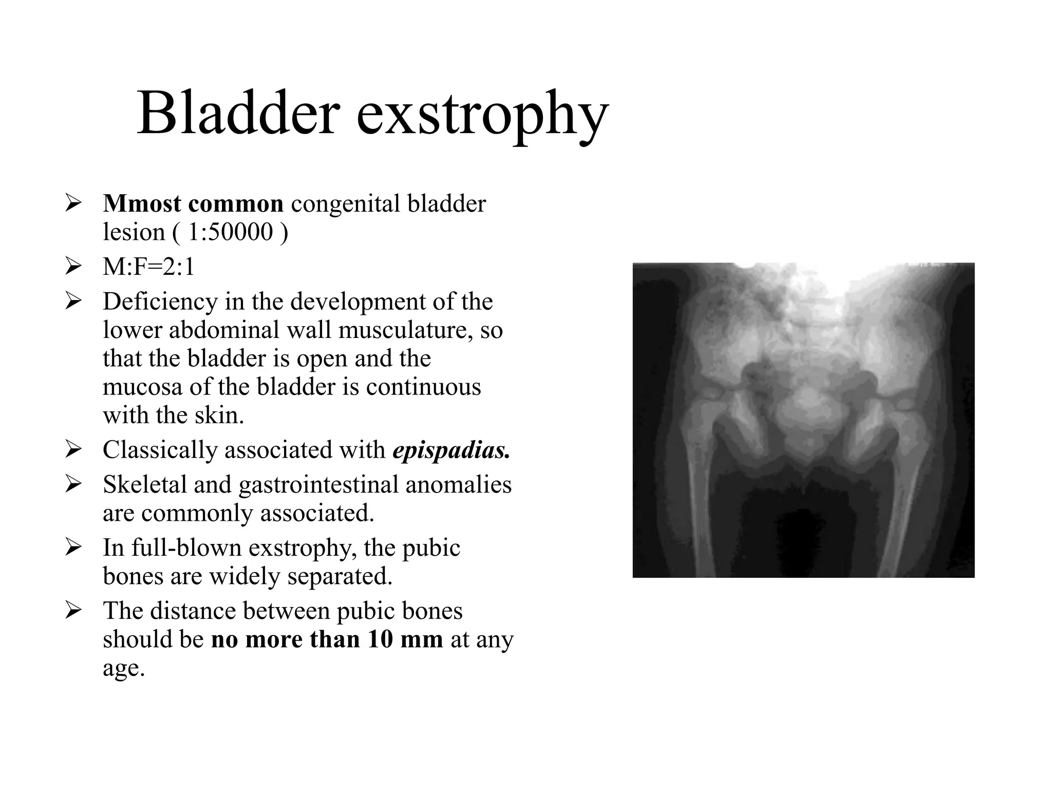 RGU MCU and its interpretation in pathology of Urinary Bladder ...