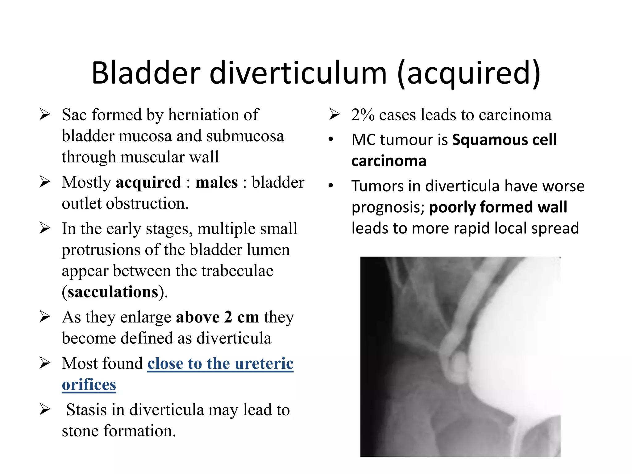 RGU MCU and its interpretation in pathology of Urinary Bladder ...