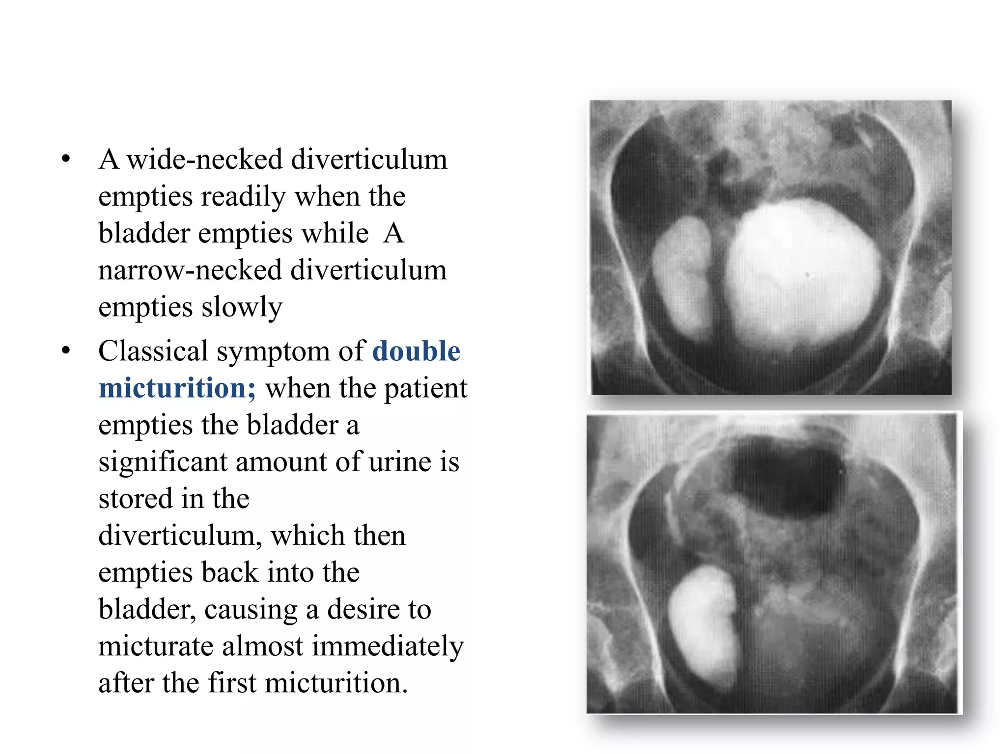 RGU MCU and its interpretation in pathology of Urinary Bladder ...