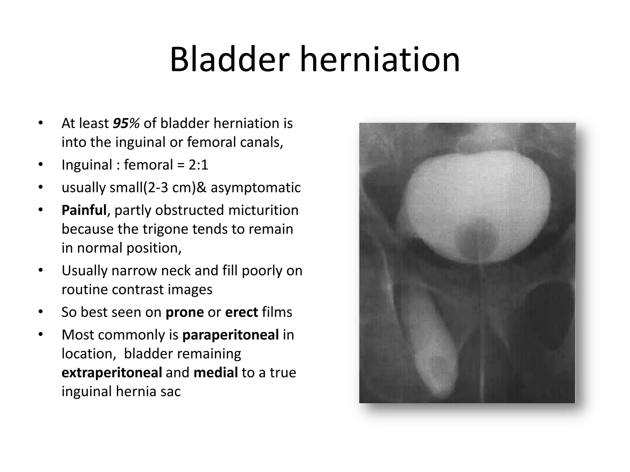 RGU MCU and its interpretation in pathology of Urinary Bladder ...