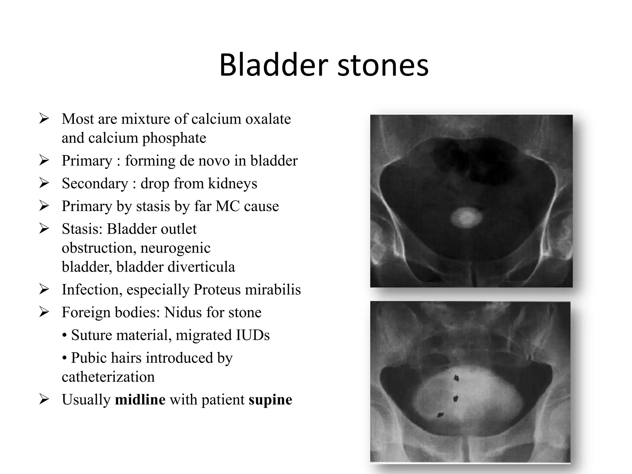 RGU MCU and its interpretation in pathology of Urinary Bladder ...