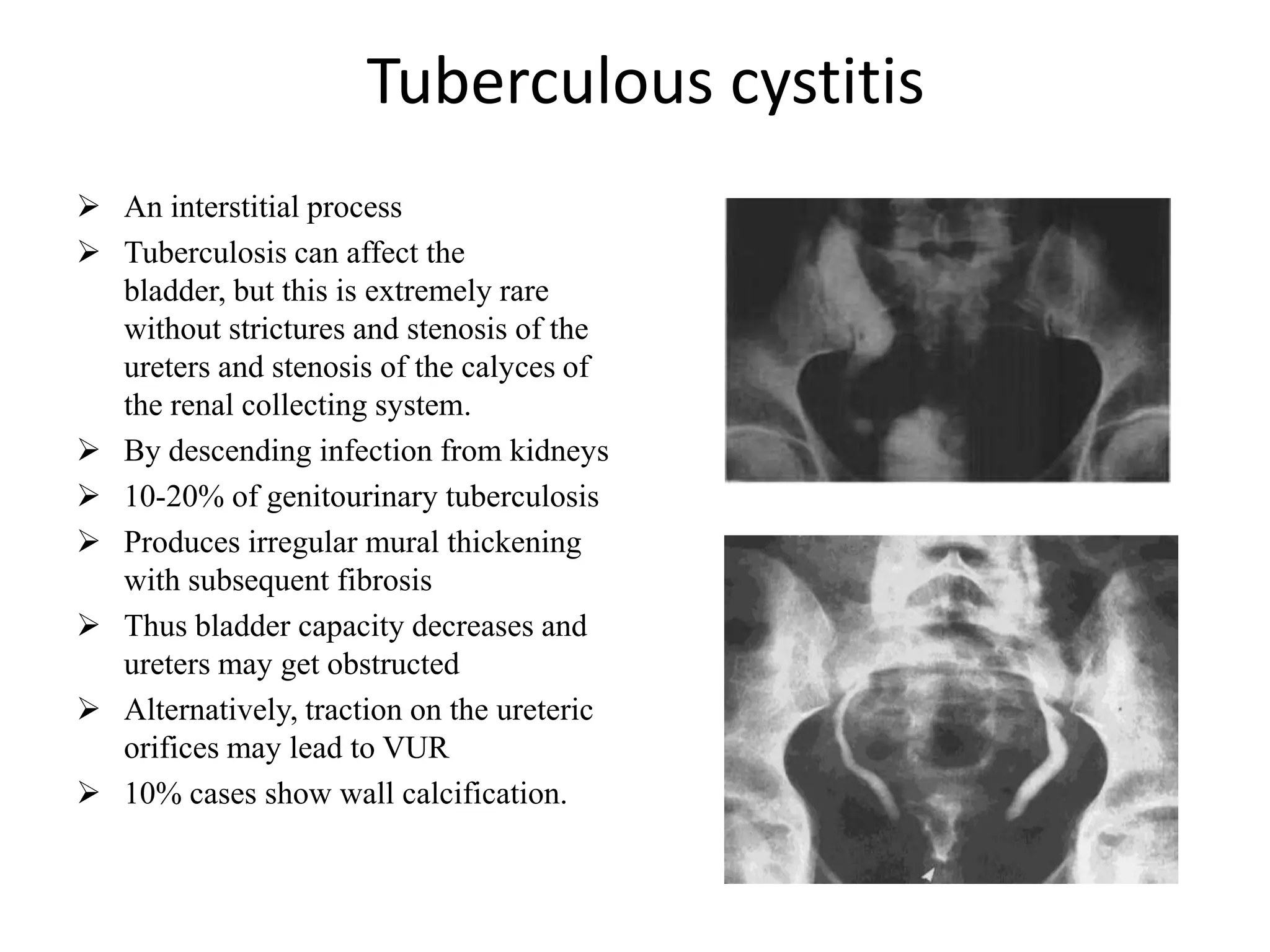 RGU MCU and its interpretation in pathology of Urinary Bladder ...