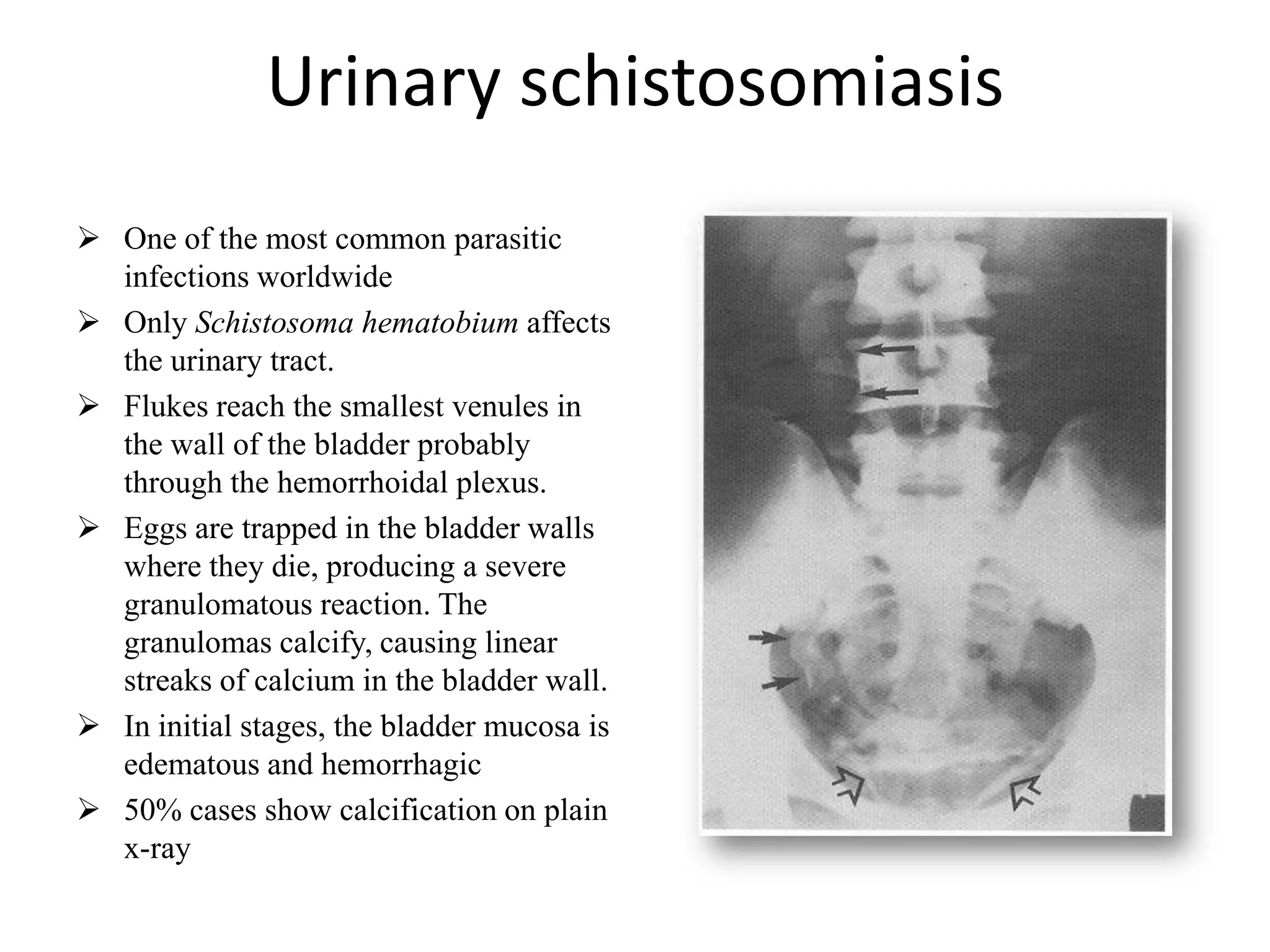 RGU MCU and its interpretation in pathology of Urinary Bladder ...