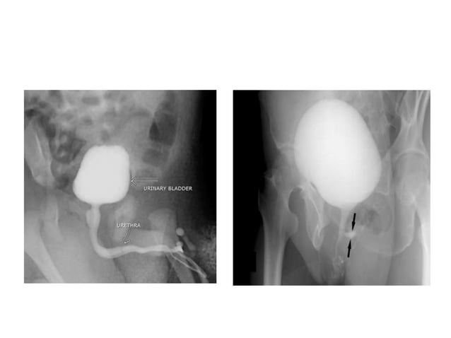 RGU MCU and its interpretation in pathology of Urinary Bladder ...
