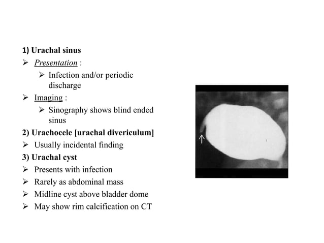 RGU MCU and its interpretation in pathology of Urinary Bladder ...