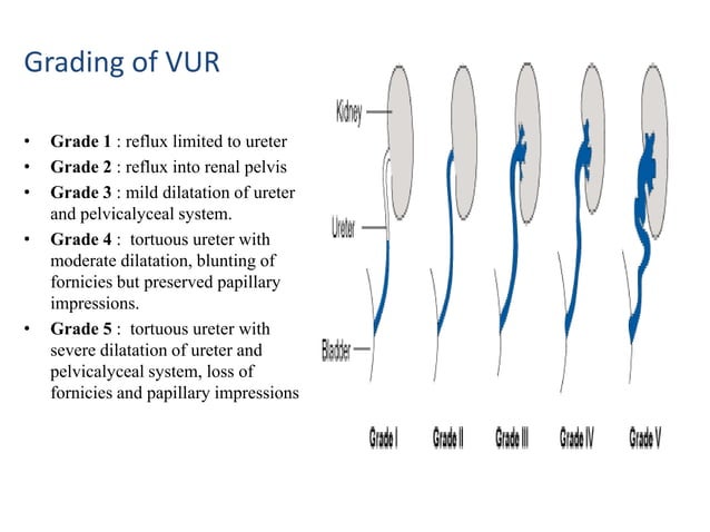 RGU MCU and its interpretation in pathology of Urinary Bladder ...