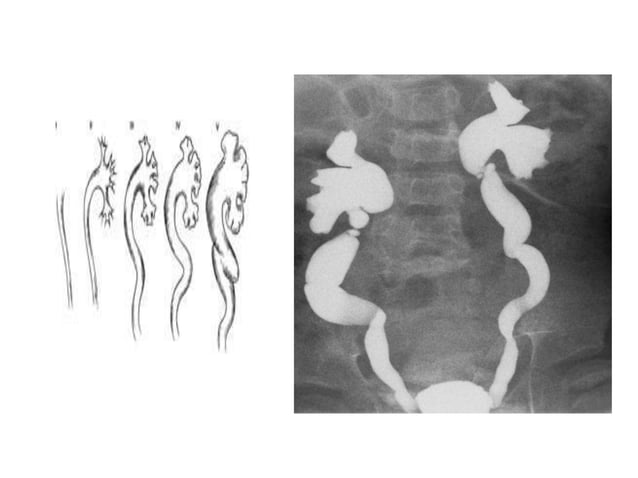 RGU MCU and its interpretation in pathology of Urinary Bladder ...