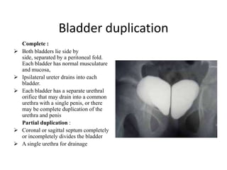 RGU MCU and its interpretation in pathology of Urinary Bladder ...