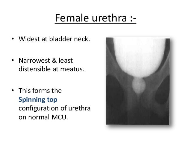RGU MCU and its interpretation in pathology of Urinary Bladder & Uret…