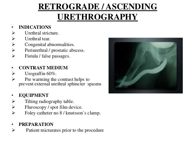 RGU MCU and its interpretation in pathology of Urinary Bladder & Uret…