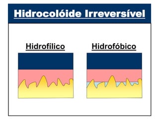 MD - Aula 5 - Materiais de Moldagem - Hidrocolóides - Cópia.ppt