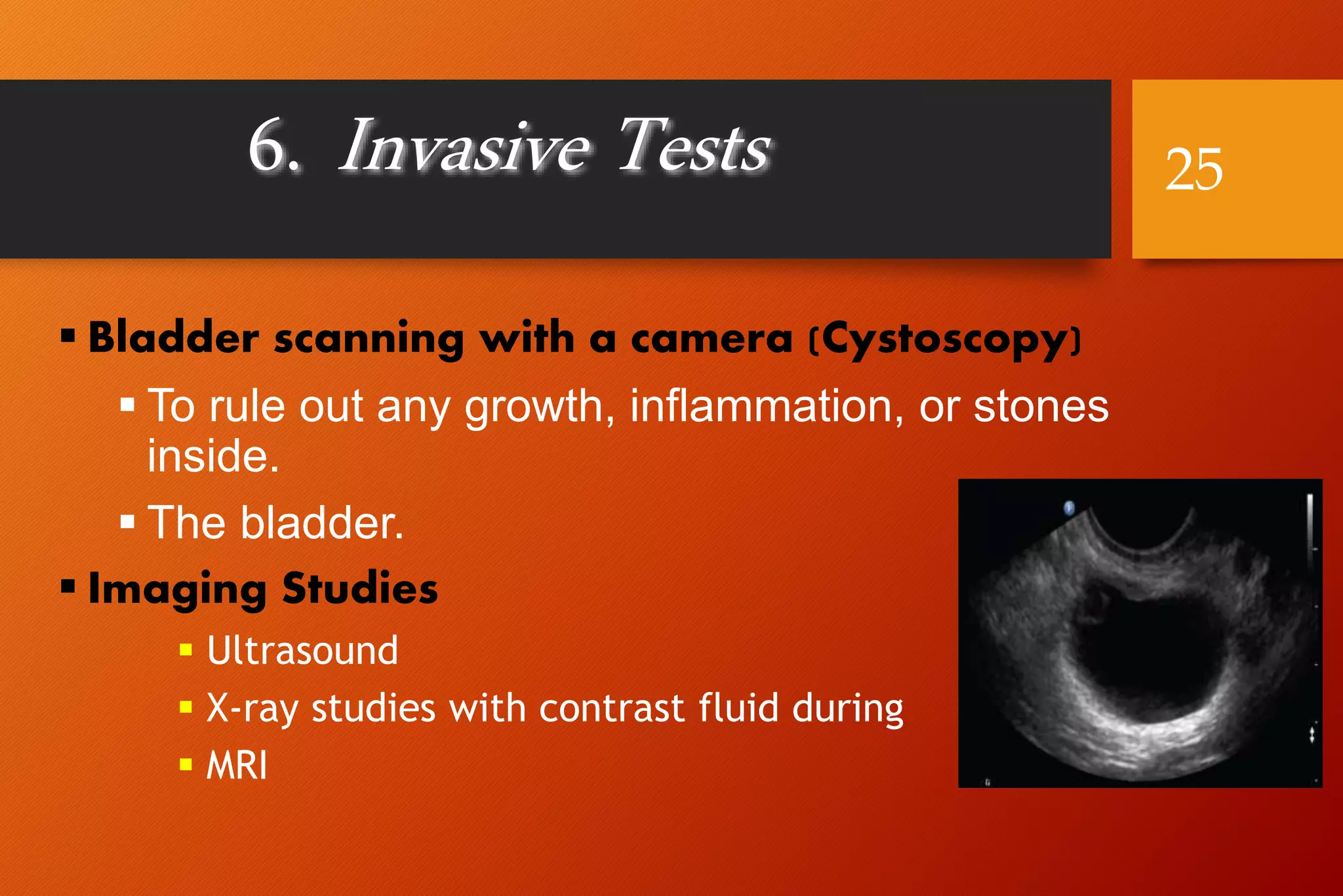Stress Urinary Incontinence | PPTX