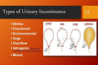 Stress Urinary Incontinence | PPTX