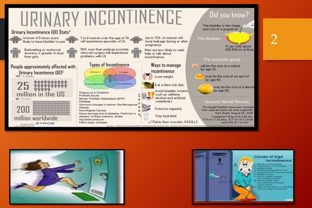 Stress Urinary Incontinence | PPTX | Sexual Conditions | Sexual Health